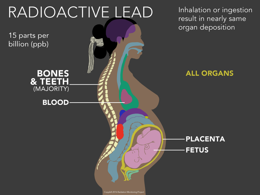 The uranium map in our bodies | Beyond Nuclear International