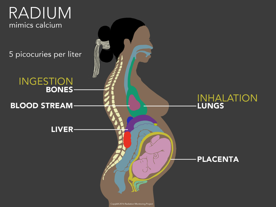 The uranium map in our bodies | Beyond Nuclear International