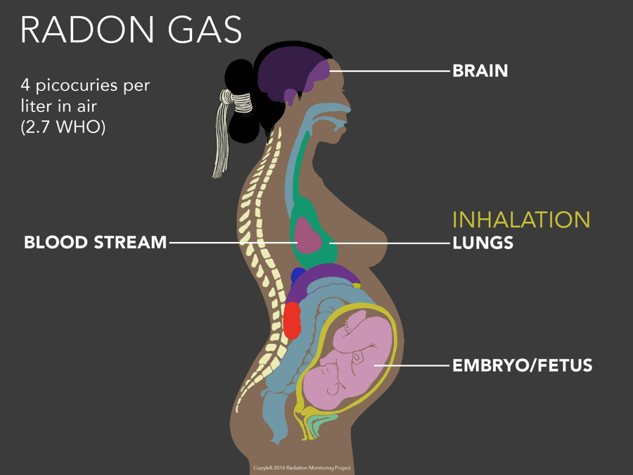 The uranium map in our bodies | Beyond Nuclear International